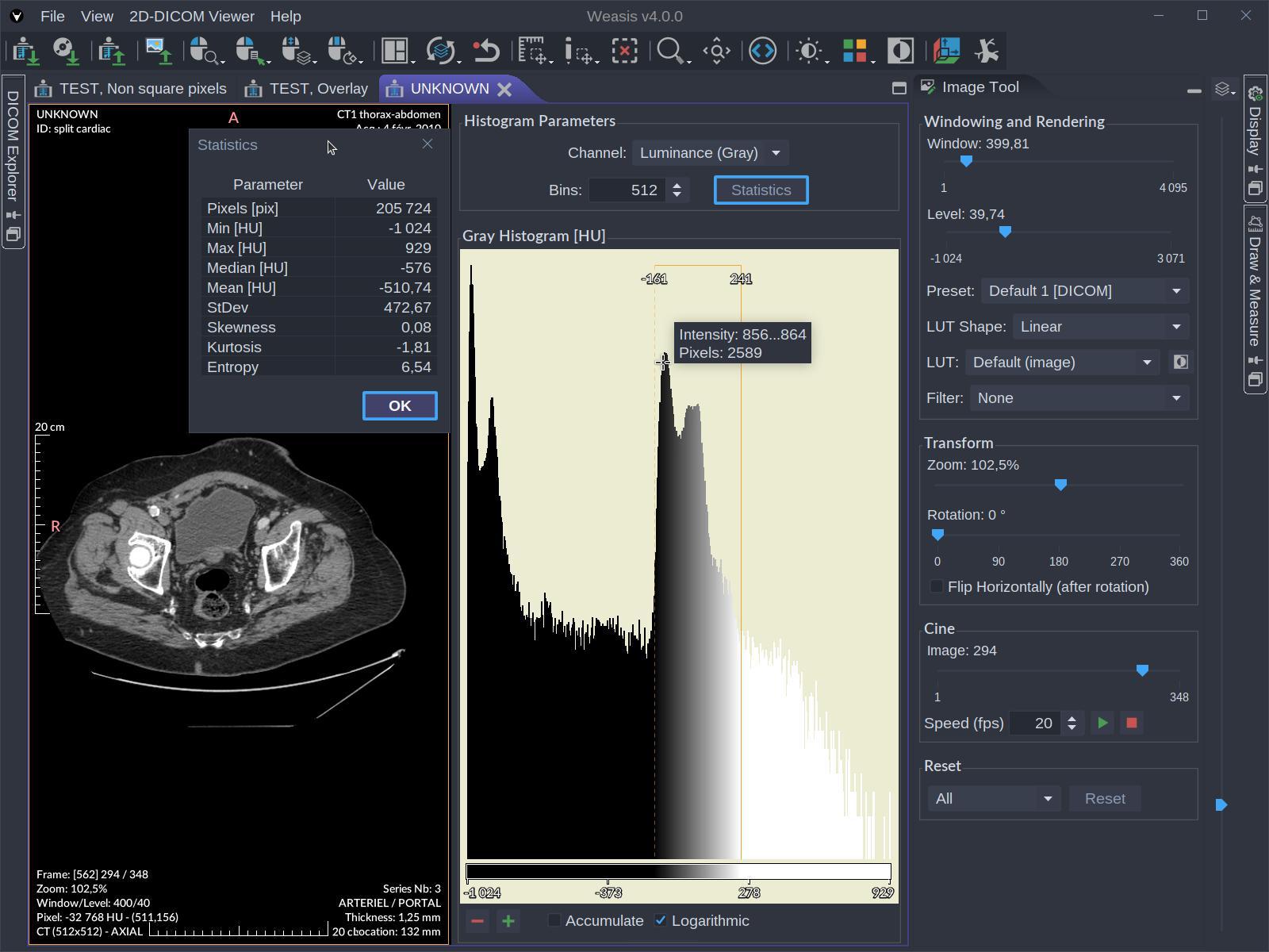 Weasis: Free DICOM viewer :: Weasis Documentation